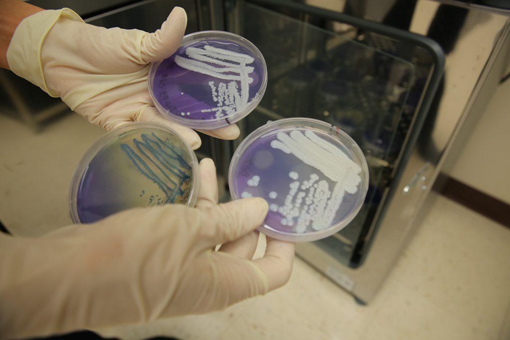 Science Meets Beer: Med School Researcher, Students Brew Up Business ...