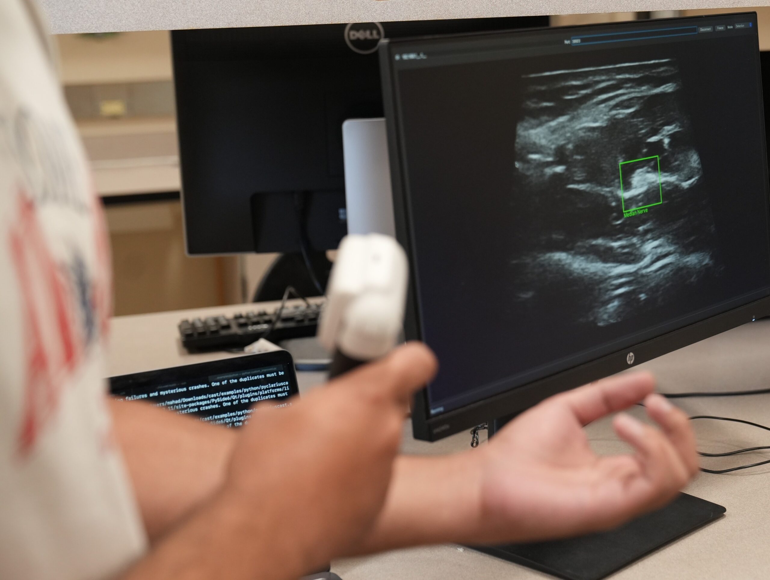 UCF Students Explore Improving Patient Care Through AI, Robotics ...